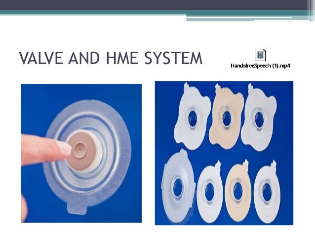 voice rehabilitation in total laryngectomy