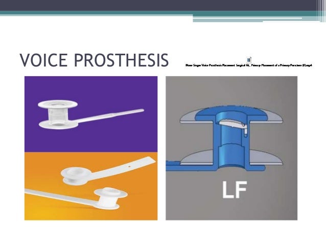 voice rehabilitation in total laryngectomy