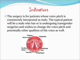 Voice change | PPT