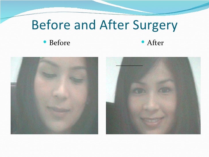 Voice change surgery-male to female or vice versa. Contact: yanhee_en…