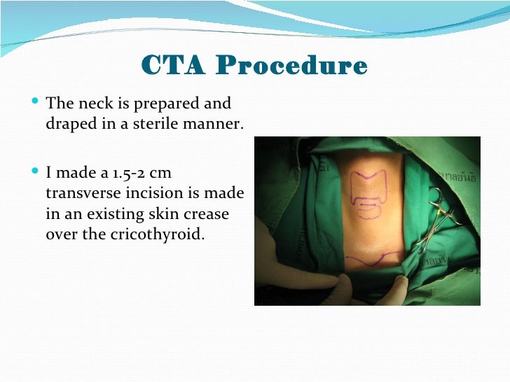 Voice change surgery-male to female or vice versa. Contact: yanhee_en…