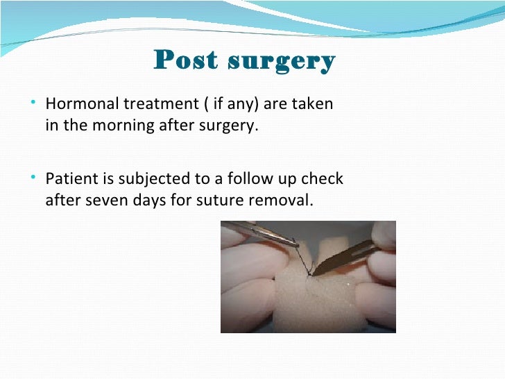 Voice change surgery - mothernimfa