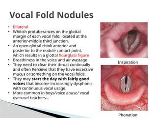 voice disorders AmmanAnatomy and P .pptx