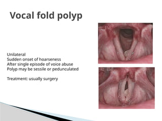 voice disorders AmmanAnatomy and P .pptx