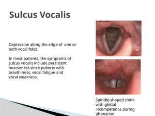 voice disorders AmmanAnatomy and P .pptx