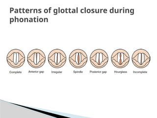 voice disorders AmmanAnatomy and P .pptx