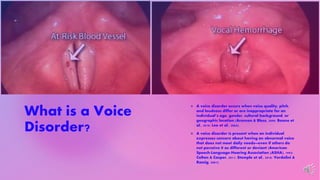 Voice Disorders in Singers.pptx