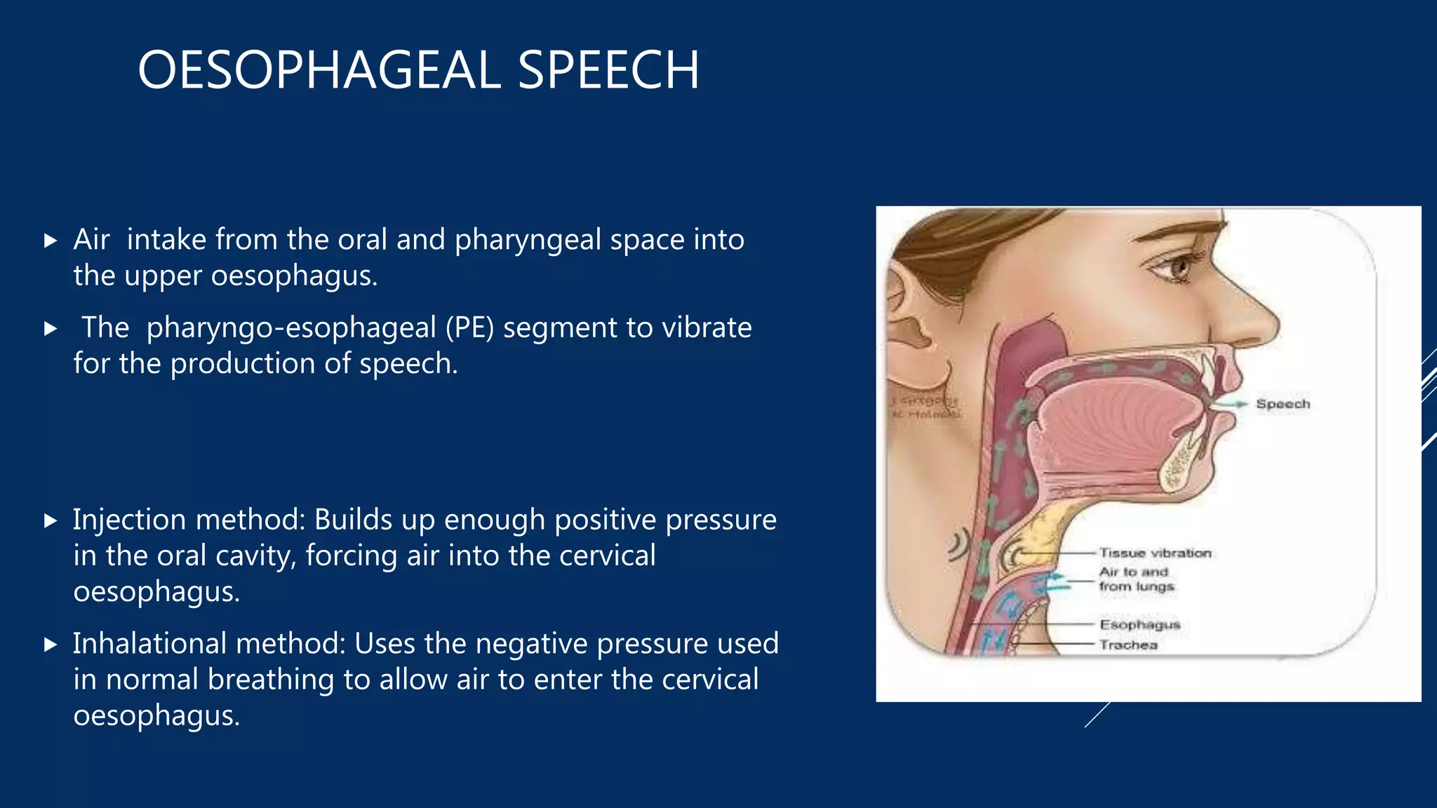 Voice rehabilitation after total laryngectomy.pptx