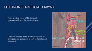 Voice rehabilitation after total laryngectomy.pptx