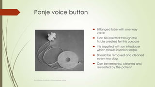 Voice rehabilitation following laryngectomy | PPTX