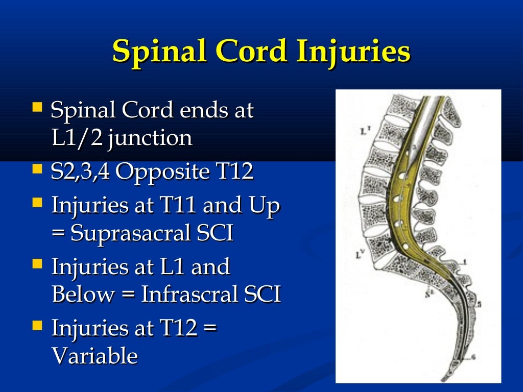 Voiding dysfunction A Simple Approach Towards Understanding and Manag…