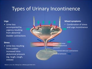 VOIDING DYS TEACHING Overactive_Bladder management plane..ppt