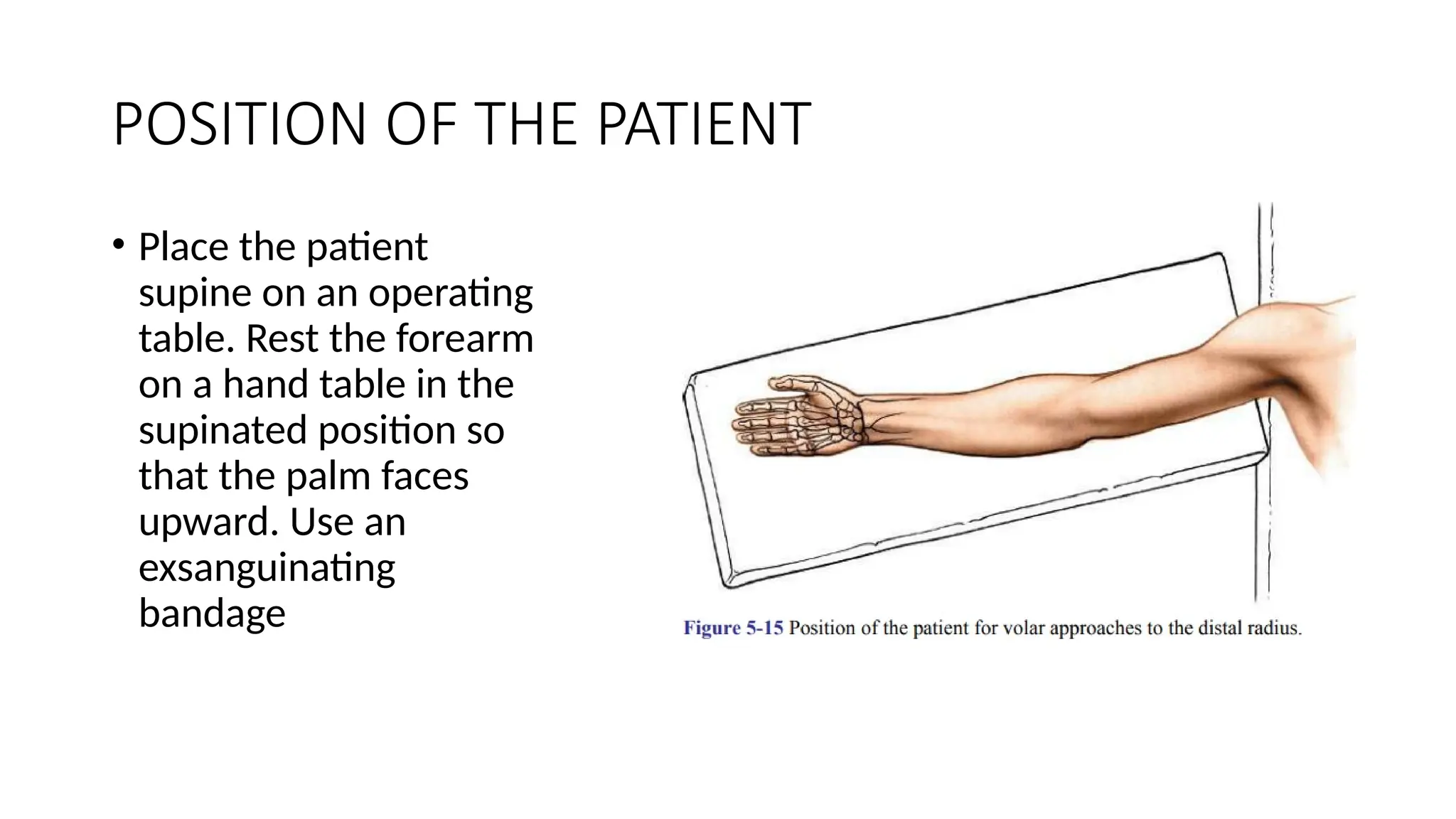 Volar Approach to the Carpal Tunnel and Wrist.pptx