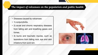 VOLCANO ERUPTION VOLCANO ERUPTIO VOLCANO ERUPTIO.ppsx | Geology | Science