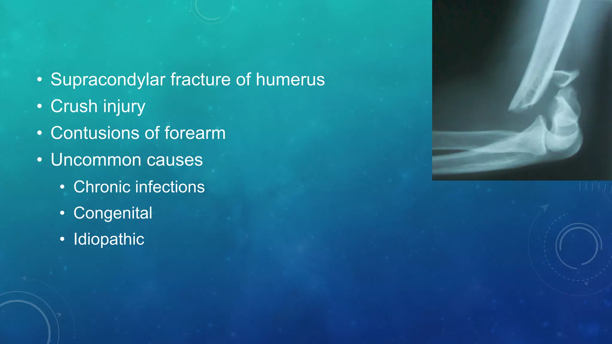 Volkmann contracture | PDF