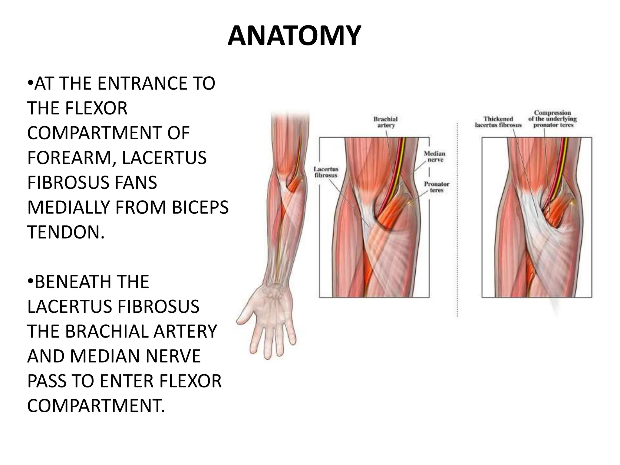 VOLKMANN ISCHEMIC CONTRACTURE SEMINAR.pptx