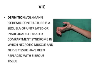 VOLKMANN ISCHEMIC CONTRACTURE SEMINAR.pptx