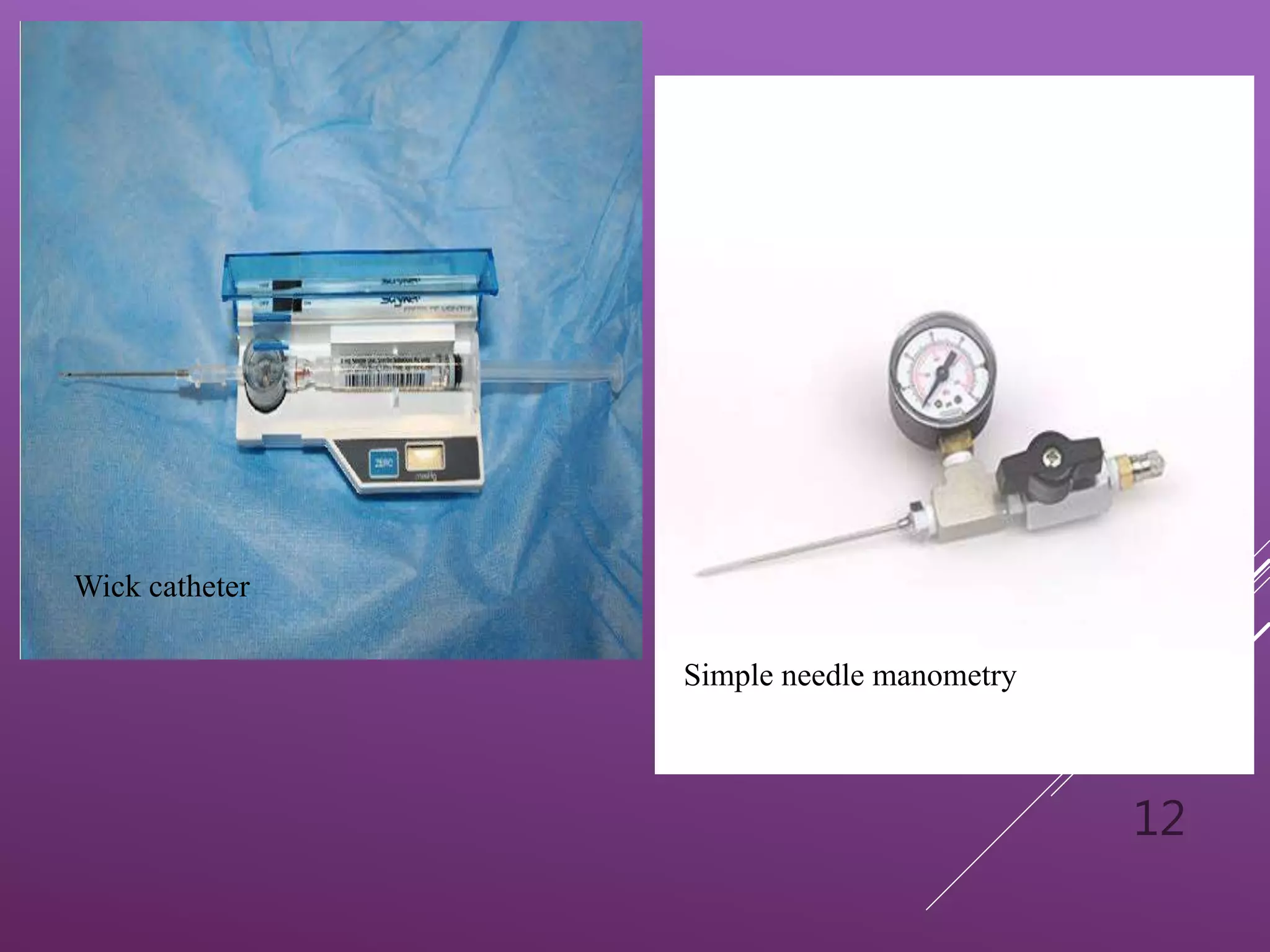Volkmann's ischaemic contracture | PPTX