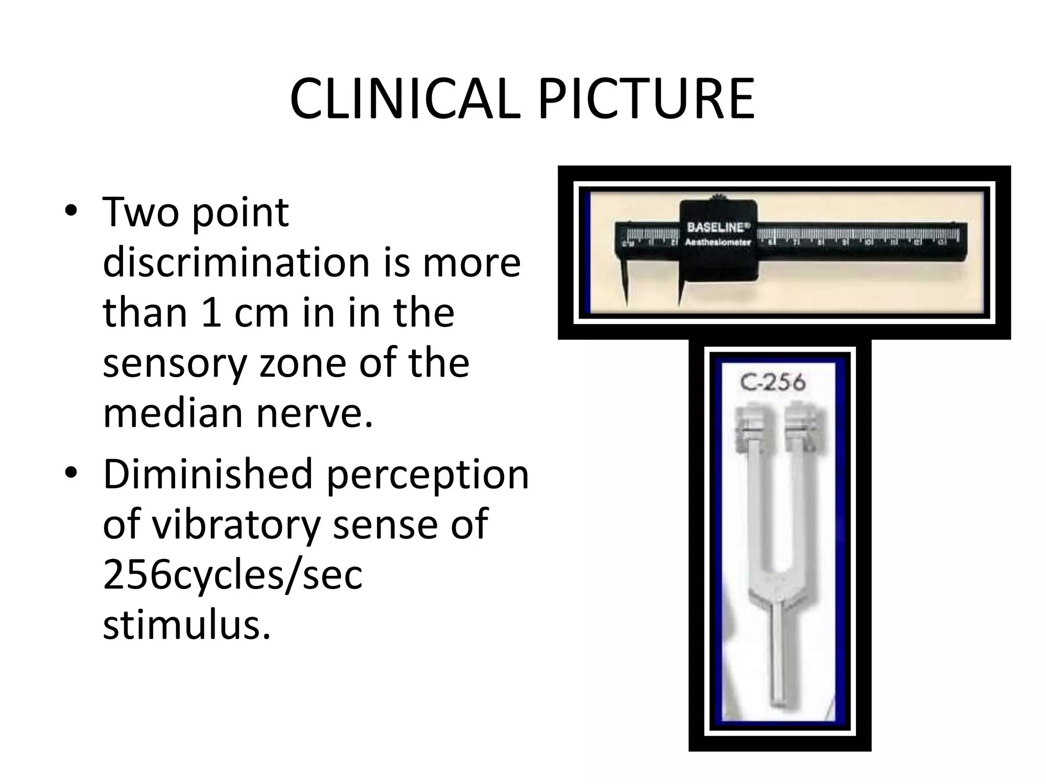 Volkmann¶s ischemic contracture | PPTX