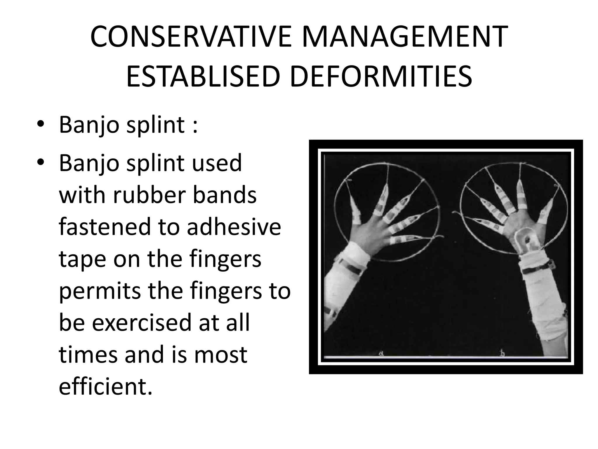 Volkmann¶s ischemic contracture | PPTX | Death, Injury, or Military ...
