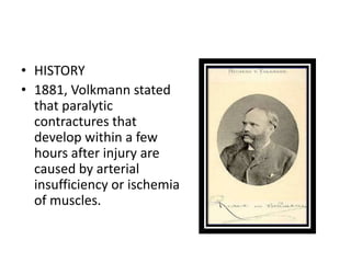 Volkmann¶s ischemic contracture | PPTX