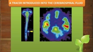 Volume neurotransmission | PPTX