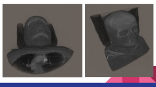 Volume Rendering in Unity3D | PDF