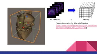 Volume Rendering in Unity3D | PDF