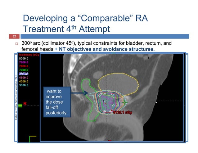 Volumetric Modulated Arc Therapy | PDF | Physics | Science