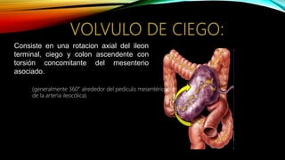 Volvulo de sigmoides y volvulo cecal | PPT