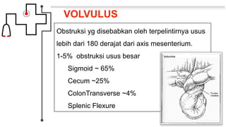 Volvulus | PPT