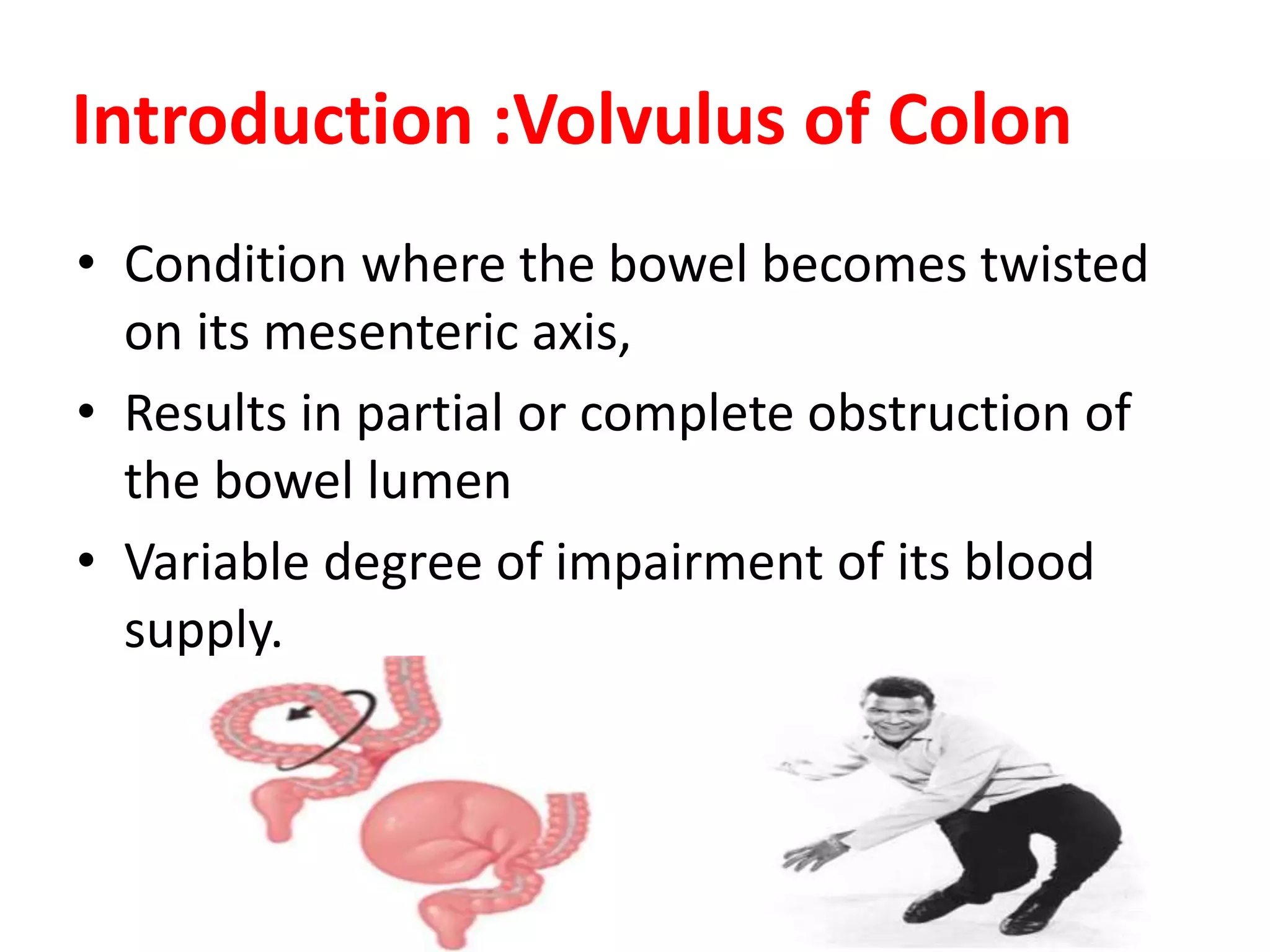 Volvulus of colon | PPTX
