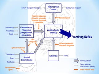 Vomiting ppt (lcps) | PPT