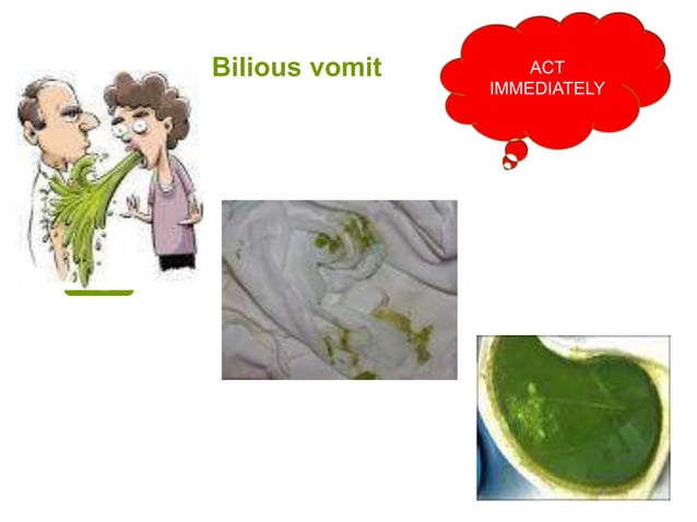 Vomiting in children | PPT