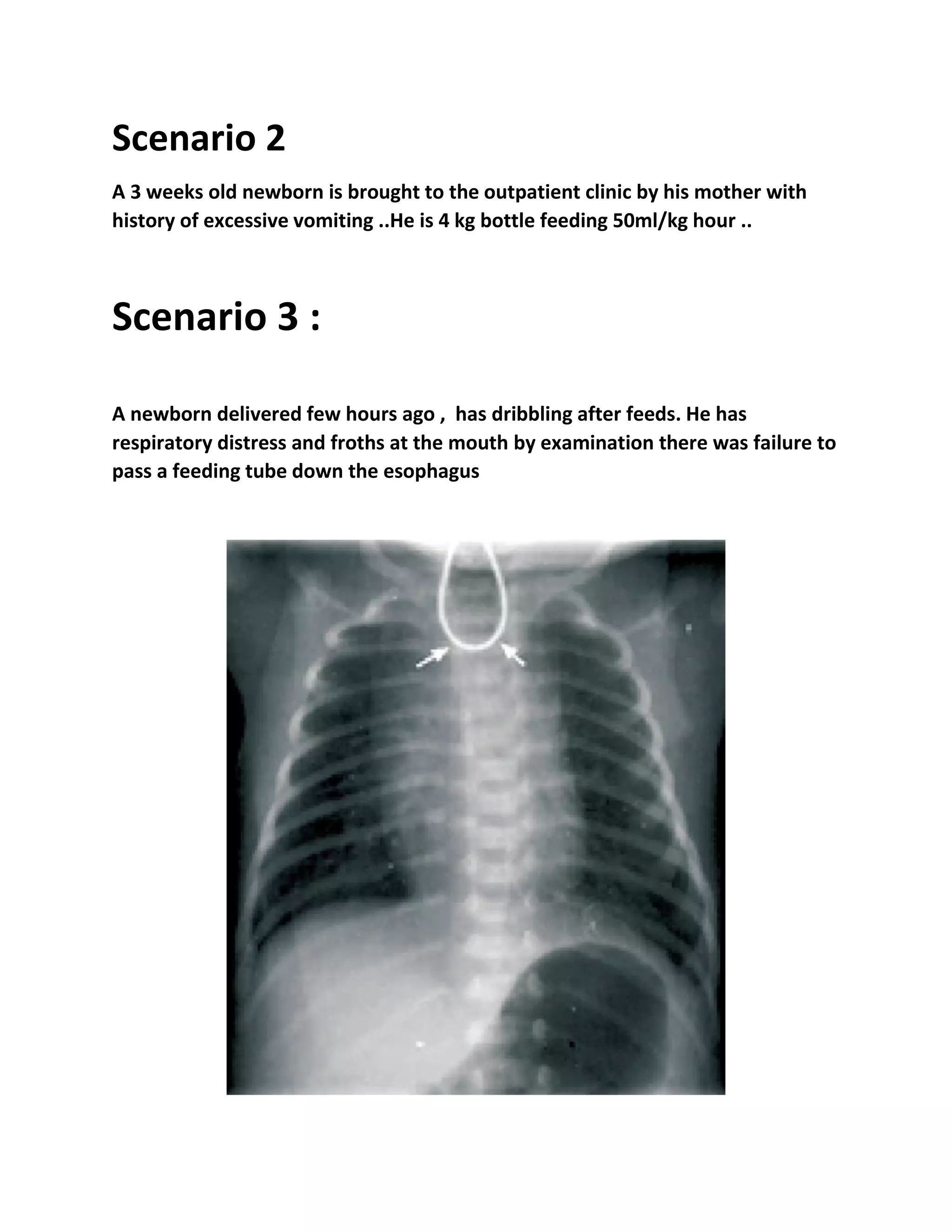 Vomiting in newborn | PDF