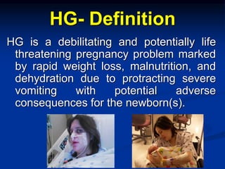 Vomiting in pregnancy for 4th year med. students | PPT