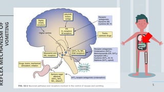 vomiting in surgery,its types,details.pptx