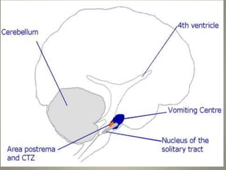 Vomiting reflex | PPTX