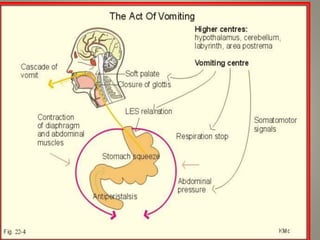 Vomiting Anatomy And Physiology