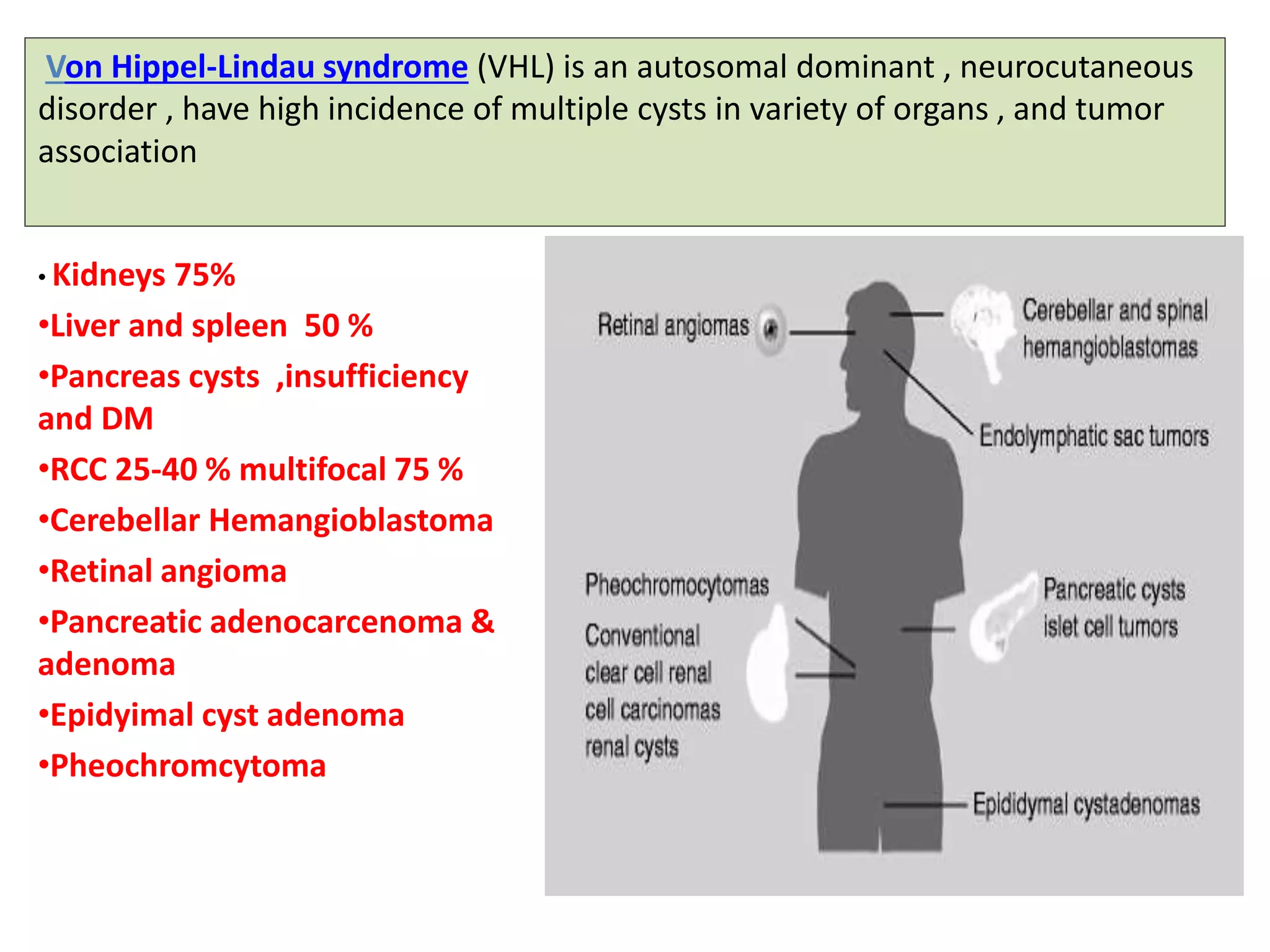 Von hippel –lindau disease | PPTX