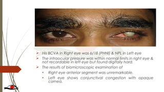 Von hippel lindau disease | PPT