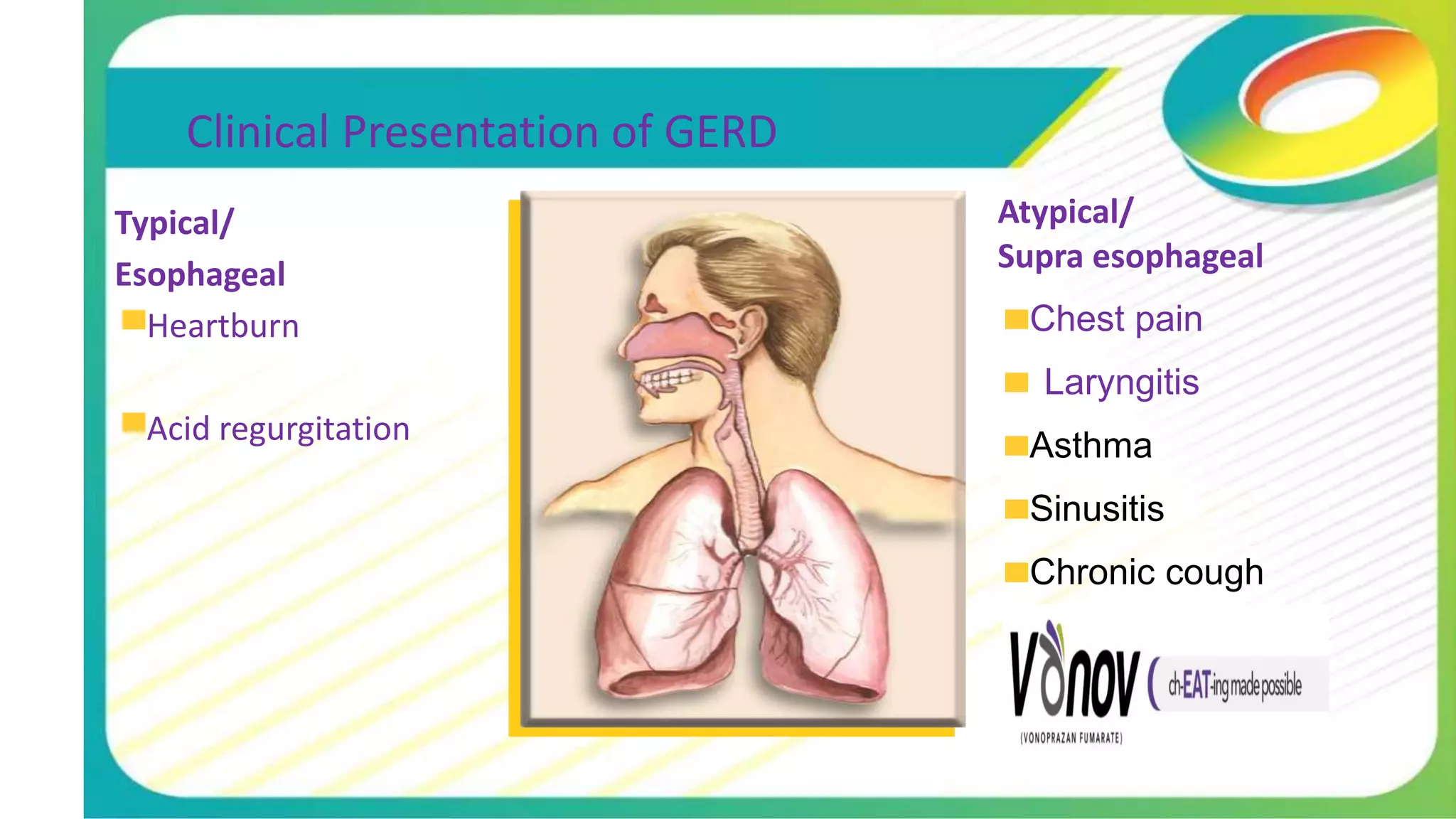 VONAPRAZAN presentation.pptx