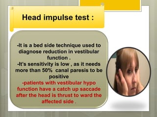 Vor tests and vertigo treatment | PPTX