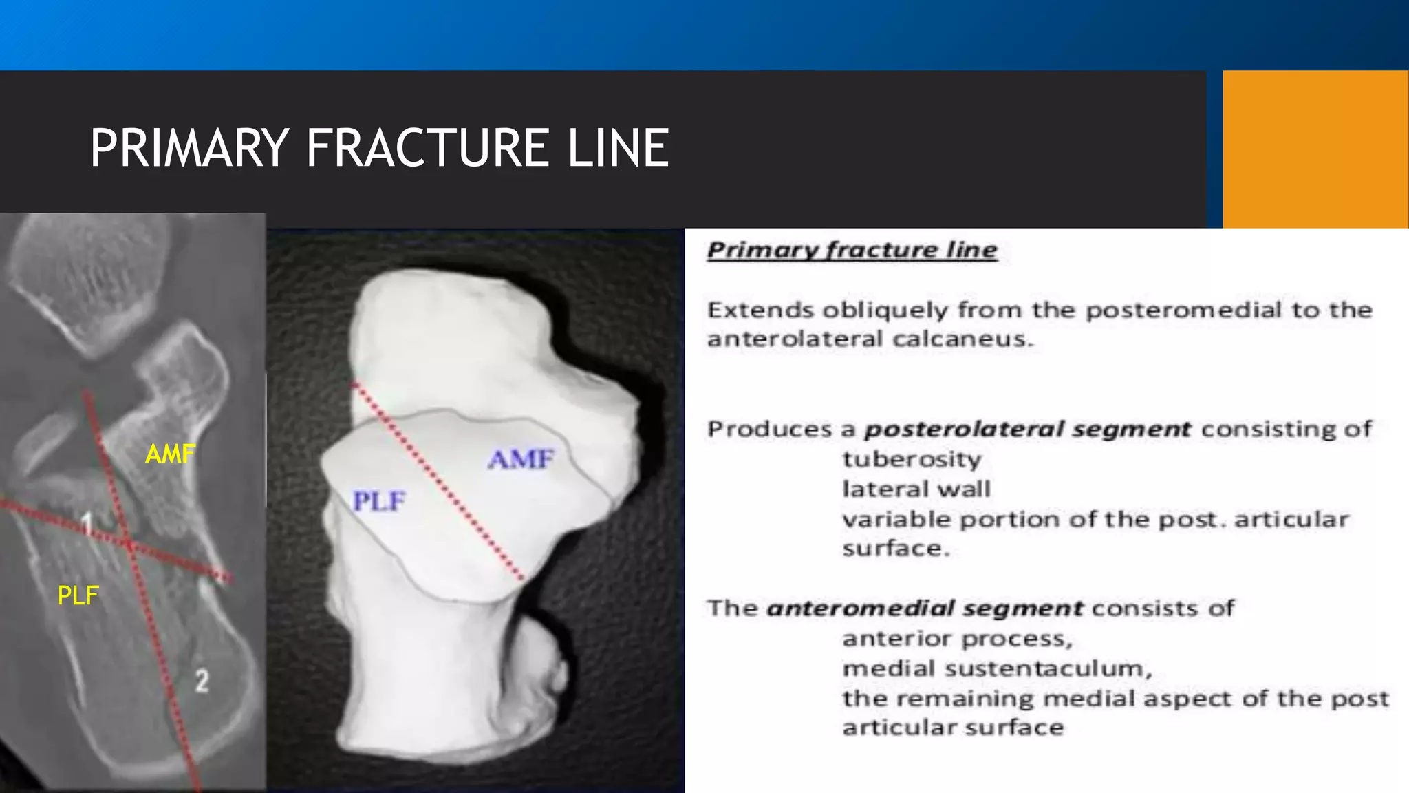 Calcaneum fracture- pathoanatomy & various fracture pattern | PPTX