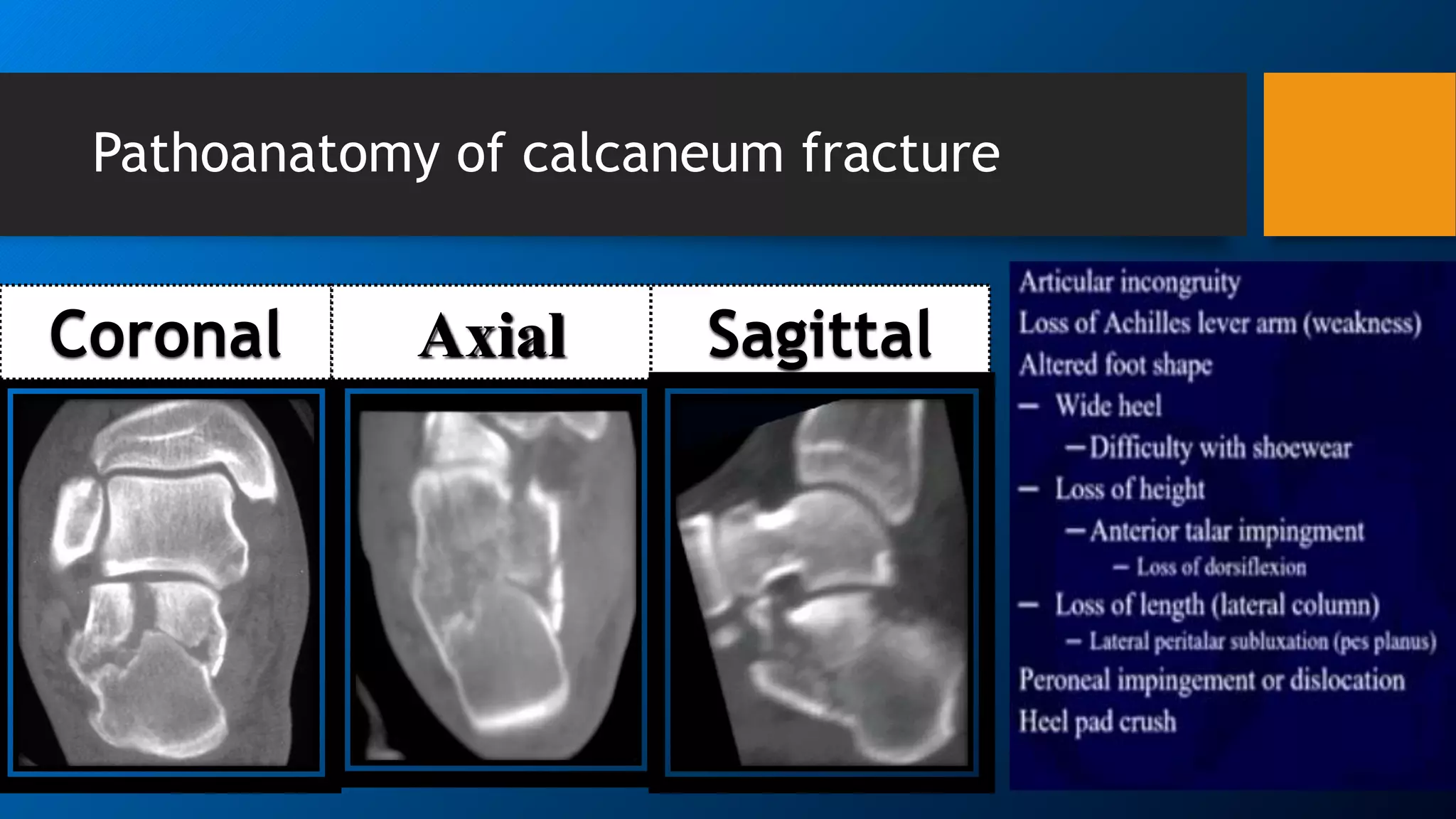 Calcaneum fracture- pathoanatomy & various fracture pattern | PPTX