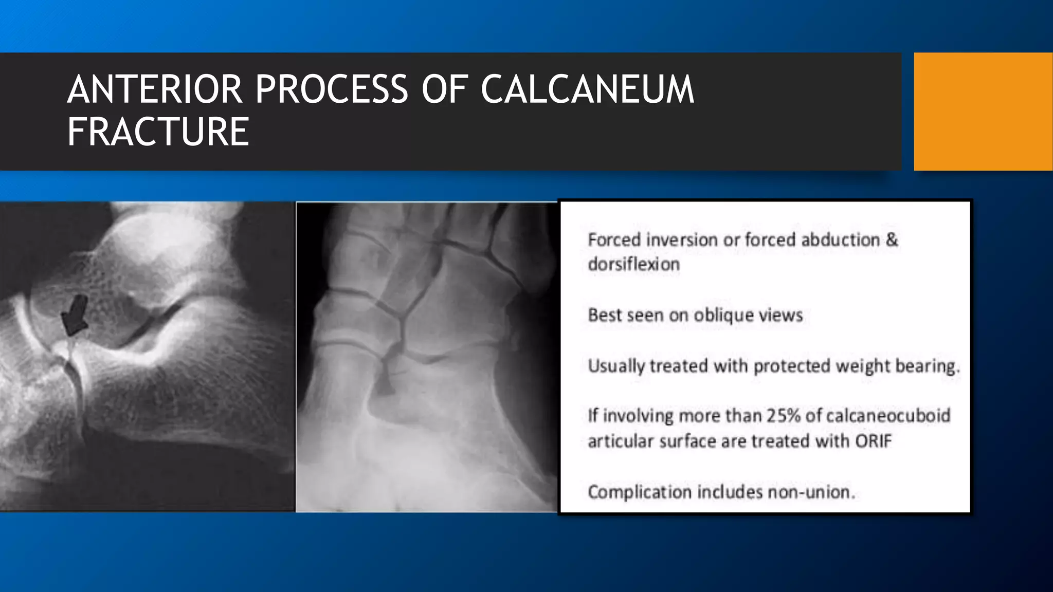 Calcaneum fracture- pathoanatomy & various fracture pattern | PPTX