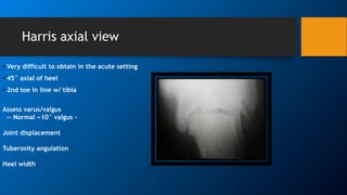 Calcaneum fracture- pathoanatomy & various fracture pattern | PPTX
