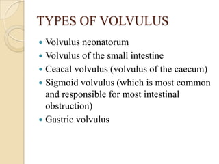Volvulus | PPTX