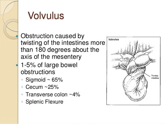 Volvulus
