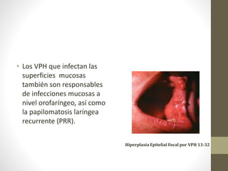 Virus del Papiloma Humano (VPH) | PPTX
